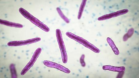 TB Background Information | Department of Agriculture, Environment and ...